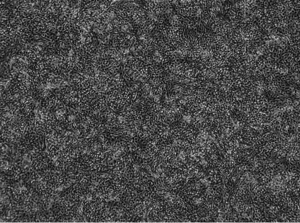 OriCell®BEND.3小鼠脑微血管内皮细胞系_价格_厂家_科研试剂-OriCell品牌-赛业（广州）生物科技